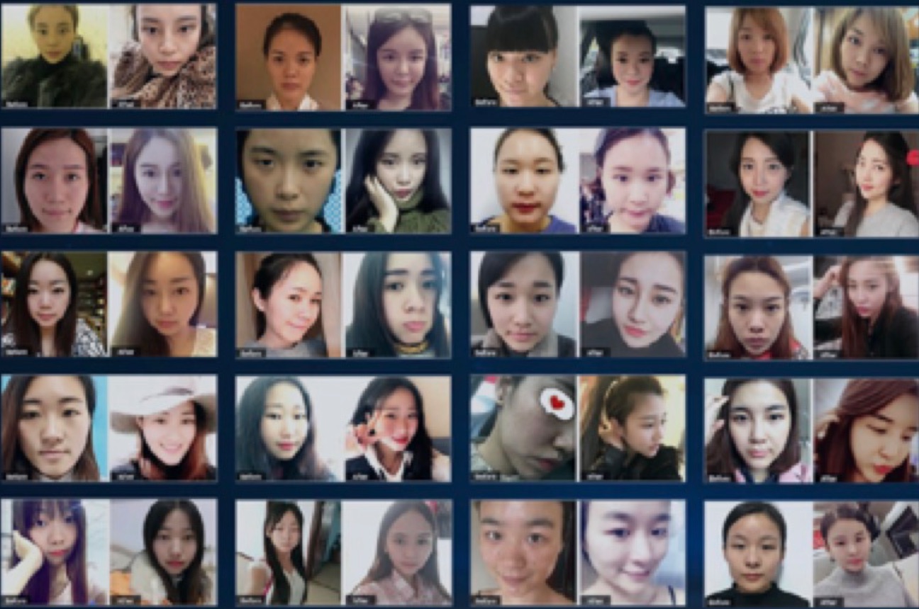 更美APP发布报告：中国正规医美市场规模4953亿，审美不再热衷“网红脸” - 动点科技